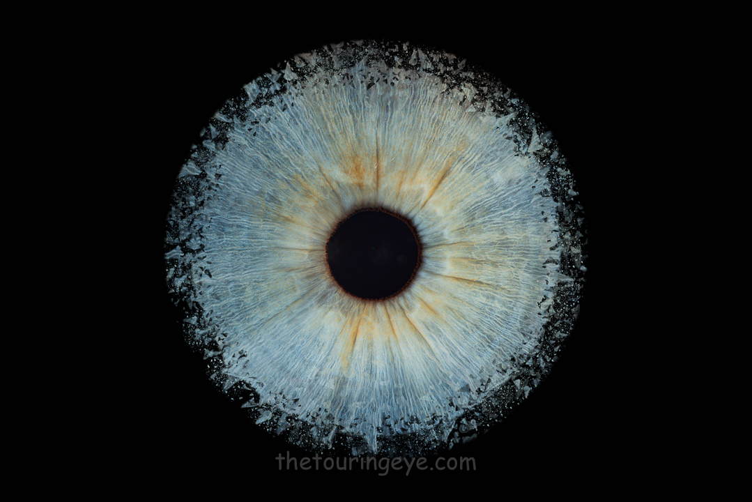 Blue Eyes: The Science, Myths, and Hidden Risks