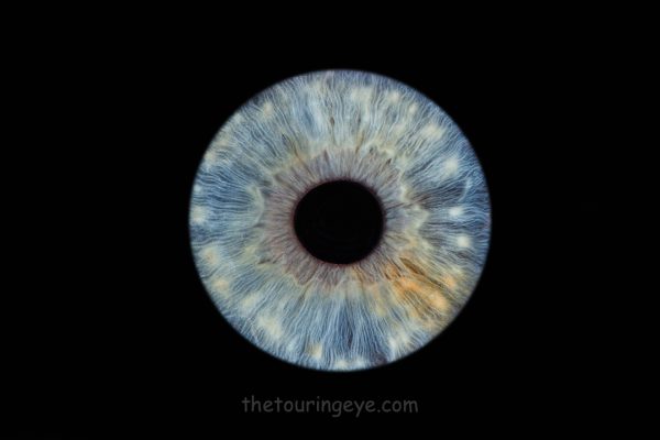 Blue Eyes: The Science, Myths, and Hidden Risks