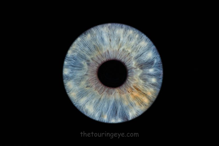 Blue Eyes: The Science, Myths, and Hidden Risks