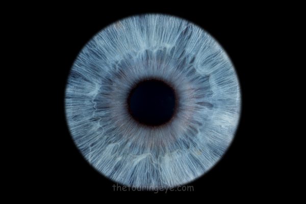 Blue Eyes: The Science, Myths, and Hidden Risks