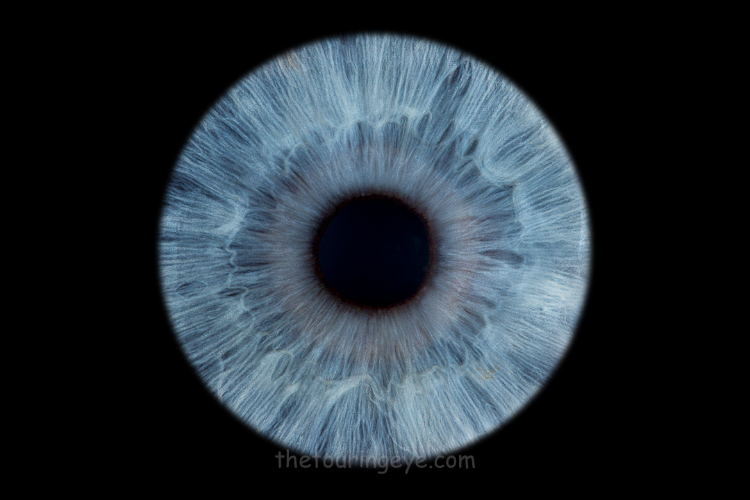 Blue Eyes: The Science, Myths, and Hidden Risks