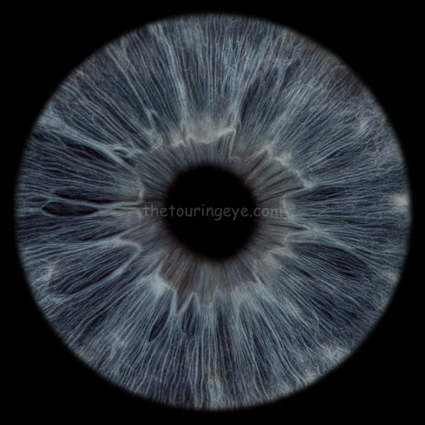 Blue Eyes: The Science, Myths, and Hidden Risks