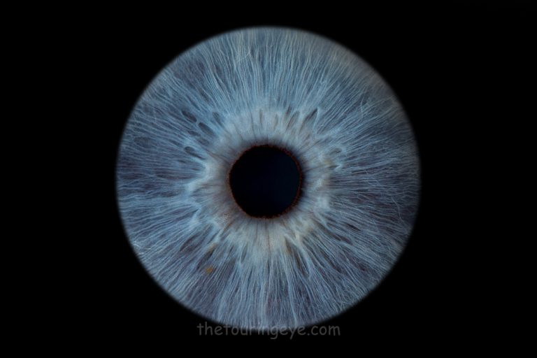 Blue Eyes: The Science, Myths, and Hidden Risks